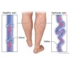 Beyond the Clot: Understanding the Role of Collateral Circulation in ...