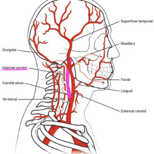 Beyond the Clot: Understanding the Role of Collateral Circulation in ...